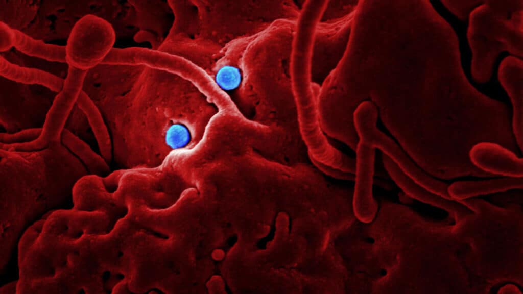 Medical Animation: How Infection Spreads Across The Human Body