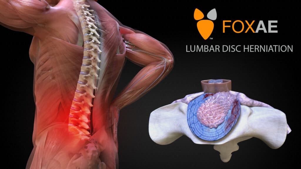 Disobedient Driver Causes Collision | FoxAE