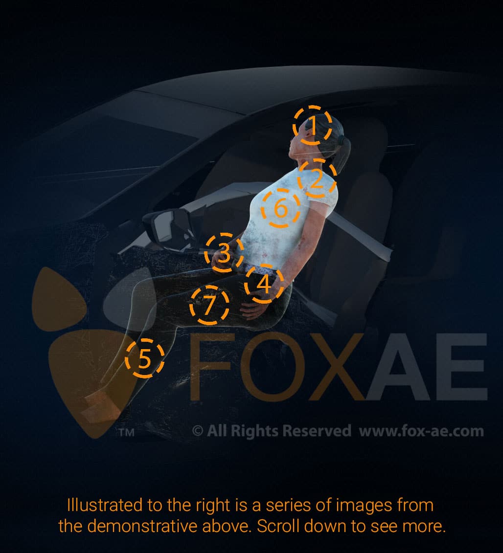 Vehicle Accident – T-bone Collision | FoxAE
