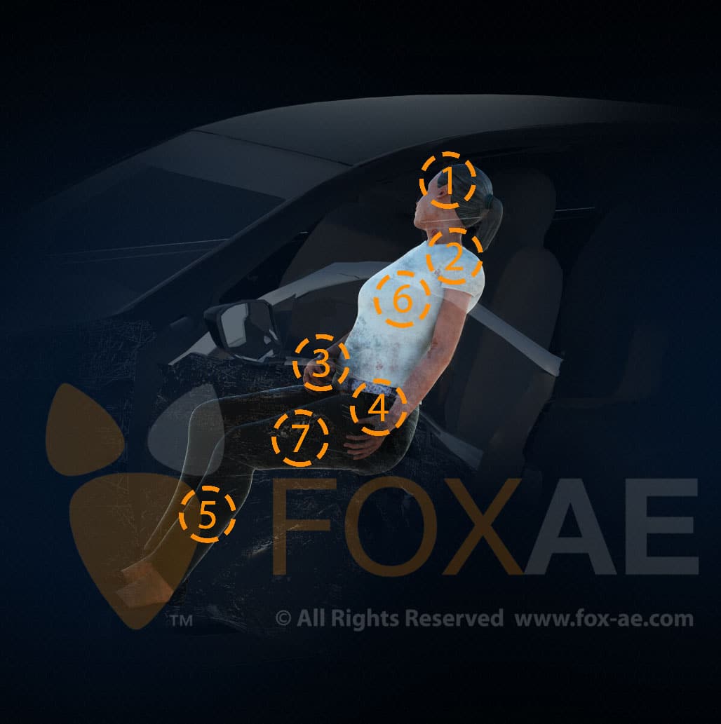 Vehicle Accident – T-bone Collision | FoxAE