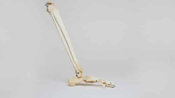 The Perks Of Using A Tibial Fracture Animation During Trial