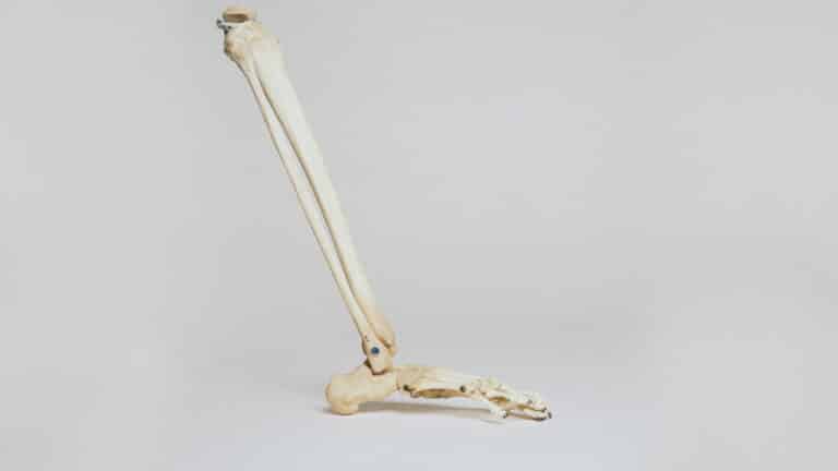 The Perks Of Using A Tibial Fracture Animation During Trial