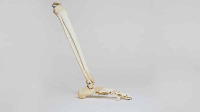 The Perks Of Using A Tibial Fracture Animation During Trial