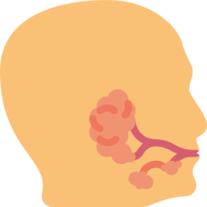Parotitis Animation: The Gravity Of Salivary Gland Infection