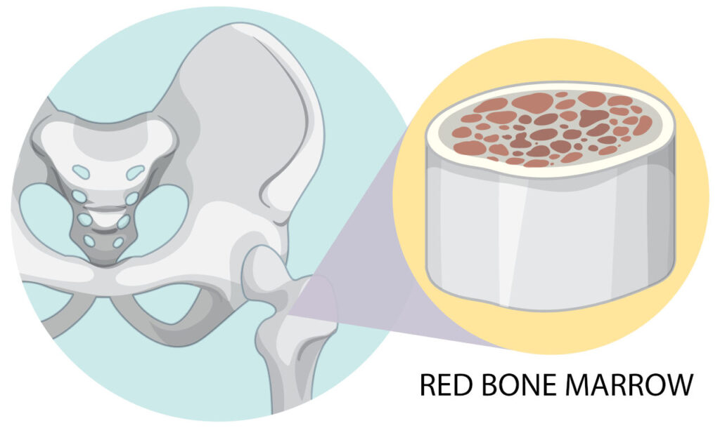 Bone Marrow Concentrate Medical Trial Animation