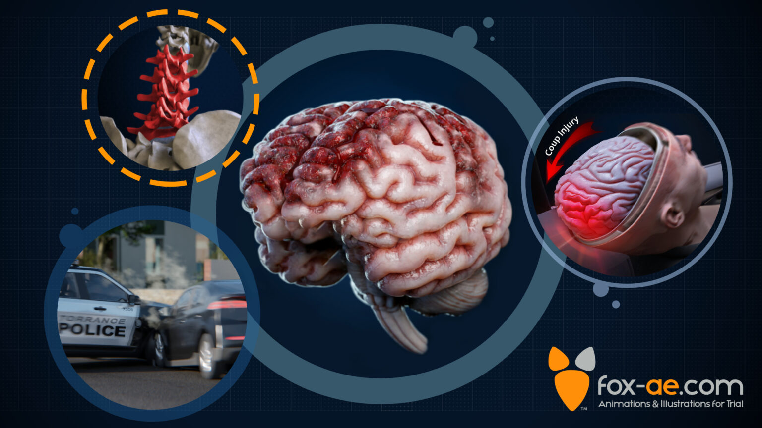 10 Most Effective Demonstrative Evidence Uses | FoxAE