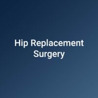 Hip Replacement Surgery | Fox Animated Engineering