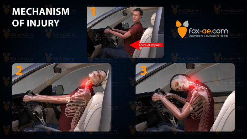 Mechanism of Injury Reconstruction | Fox Animated Engineering