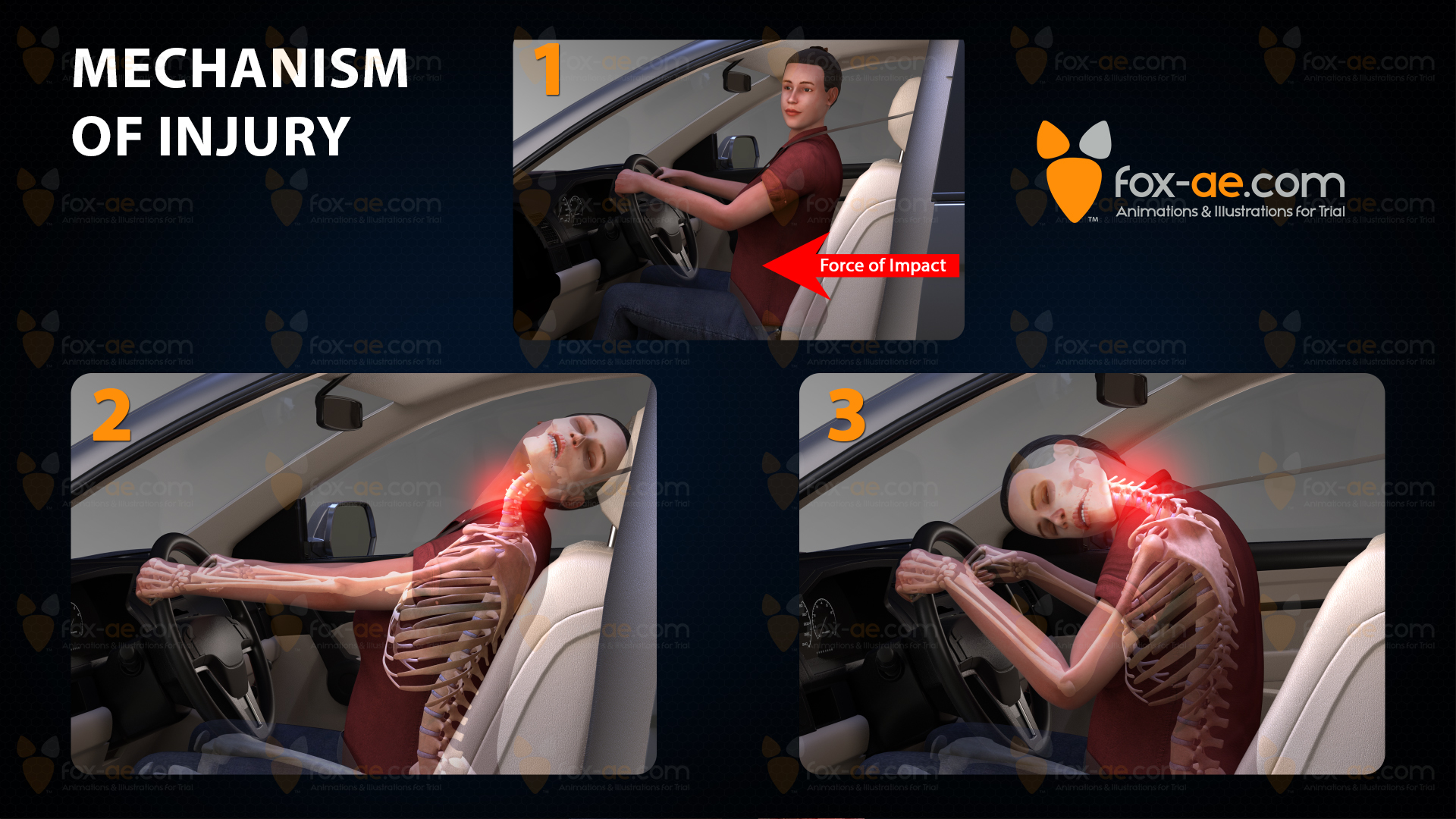 Mechanism of Injury Reconstruction | Fox Animated Engineering